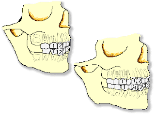 ESTOMATOLOGIA INTEGRAL COMUNITARIA: DENTICION TEMPORAL Y DENTICION ...